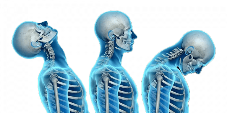 Whiplash & Life Care Plans - Intercoastal Consulting & Life Care Planning